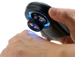 Dermatoscopia: Saiba mais sobre esse exame fundamental para sua saúde ...